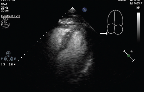 PERT Development and Implementation to Standardize Patient Pathway for ...