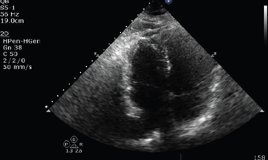 PERT Development and Implementation to Standardize Patient Pathway for ...