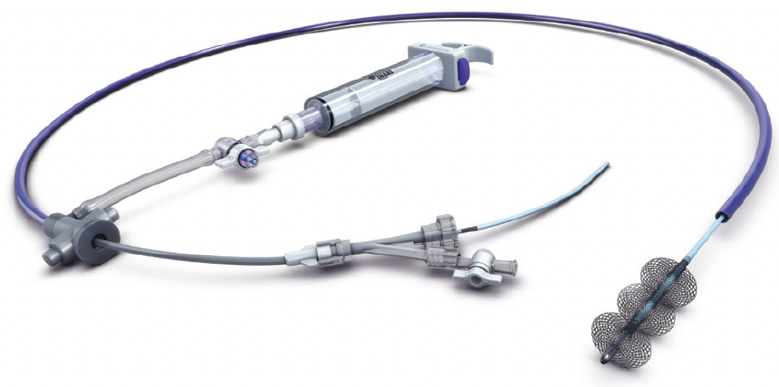 The Pursuit of Bloodless Thrombectomy - Endovascular Today