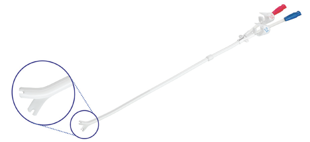 The Pristine™ Long-Term Hemodialysis Catheter: Physicians’ Perspectives ...