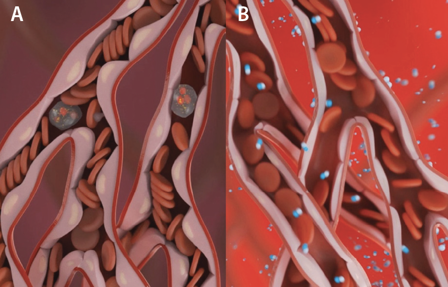 SSO2 Therapy: The Next Frontier in STEMI Care - Cardiac Interventions Today