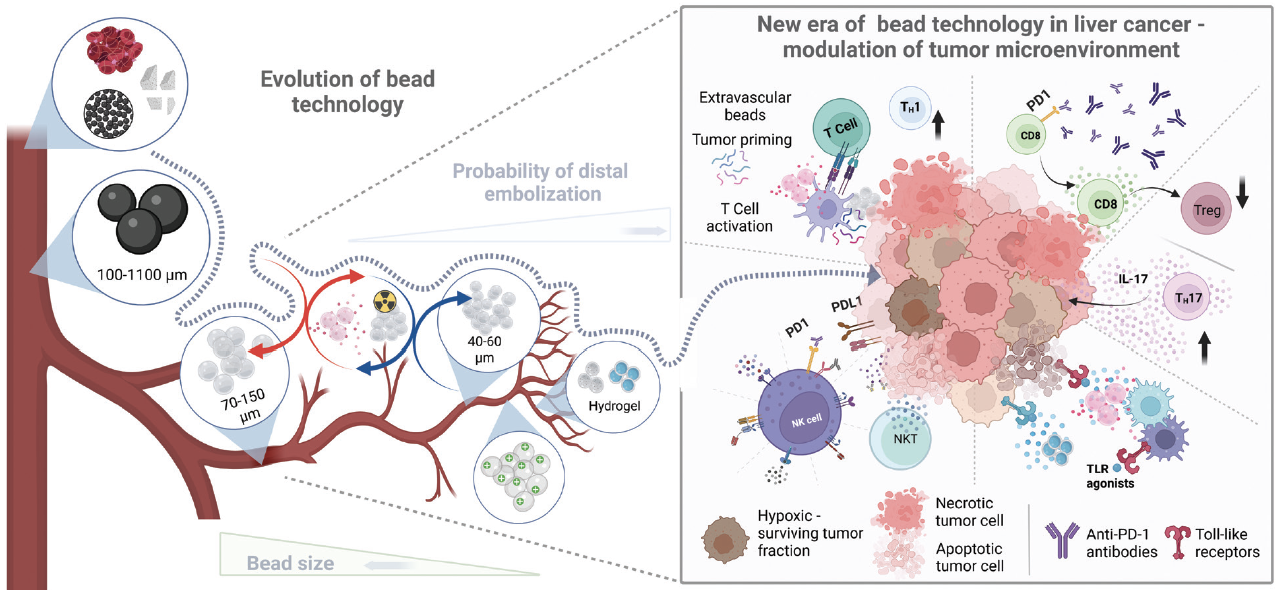Bead Technology: What’s New, What’s Next? - Endovascular Today