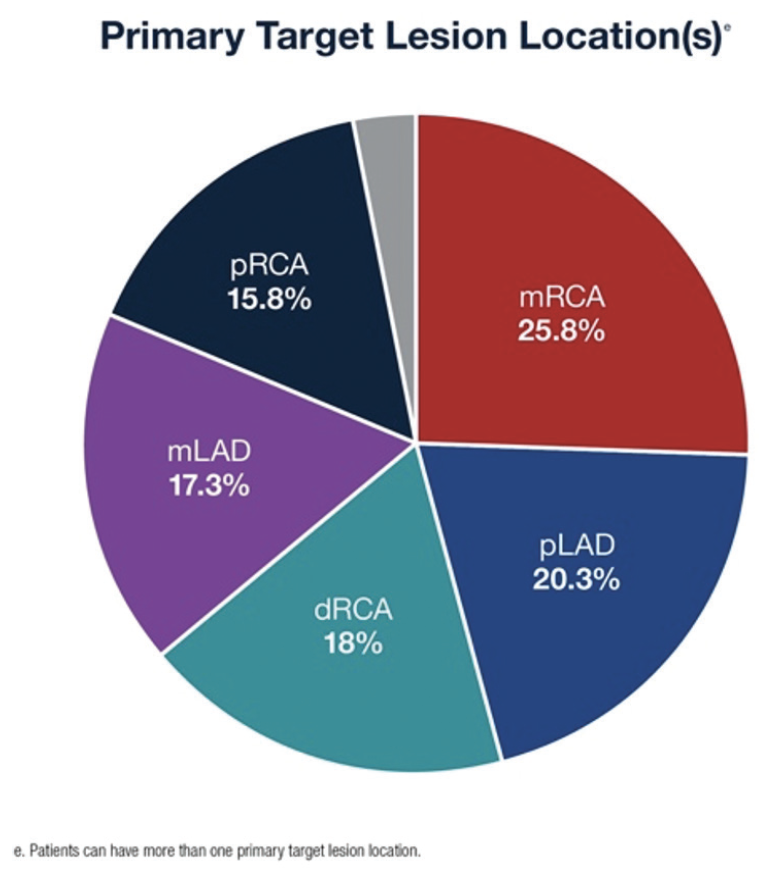 New Evidence Supports Continuous Power Aspiration With Indigo® System ...