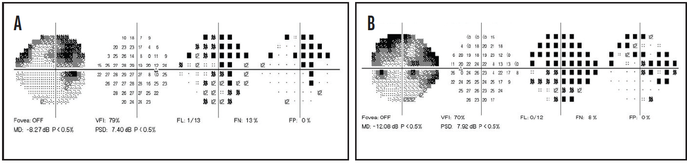 A Medical Optometrist’s Guide to MRI - Modern Optometry
