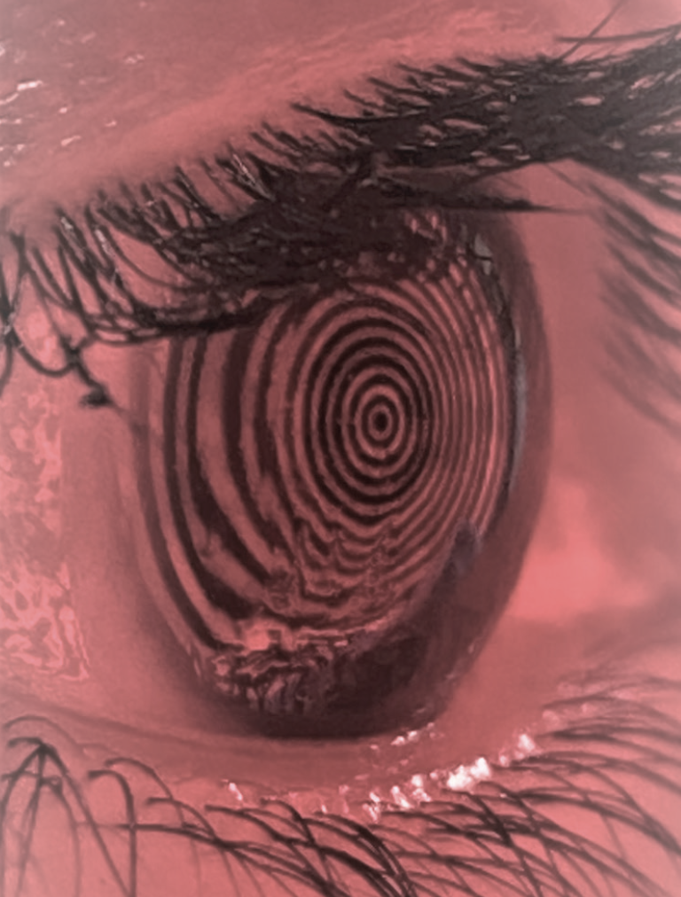 Five Rules of Thumb for Managing the Ocular Surface - Modern Optometry