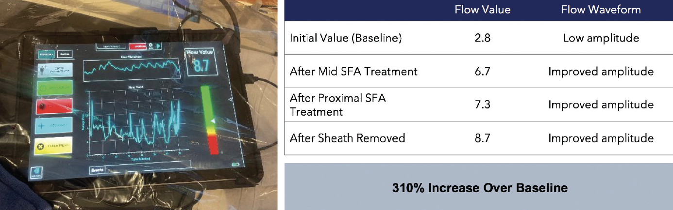 Utility of the FlowMet™ Peripheral Blood Flow Monitoring System for ...