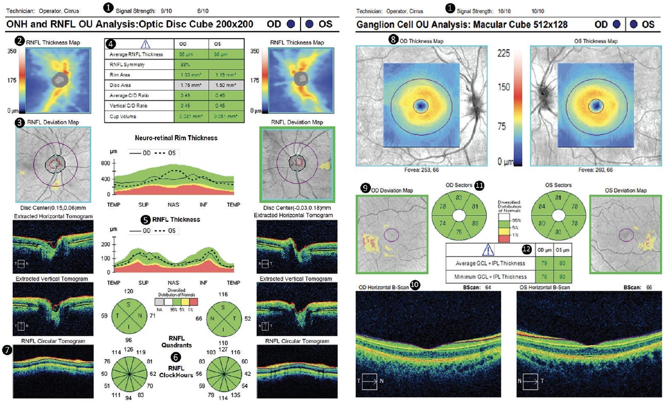 Oct Eye Test OCT & RETINAL DIGITAL IMAGING Feltham EyeCare Centre