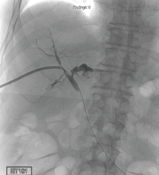 State of the Art in Interventional Oncology: Case Discussions ...
