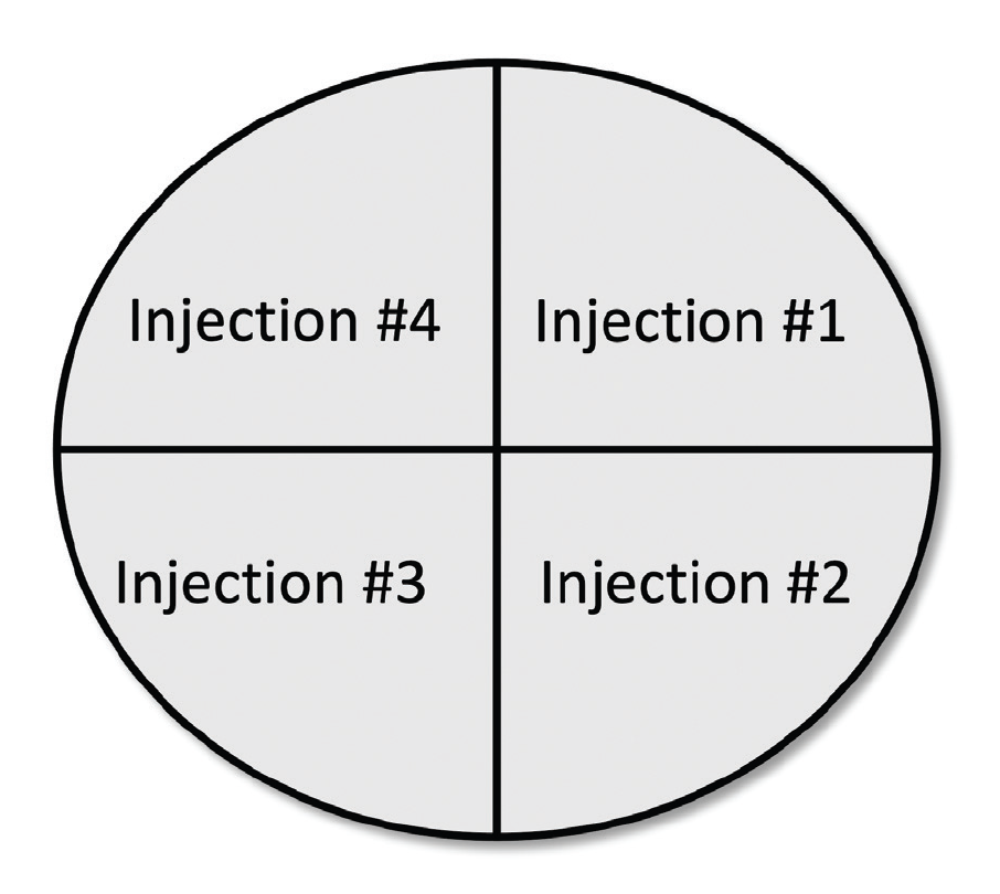Intratumoral Therapies: How to Prepare Your Team for the Coming Wave ...