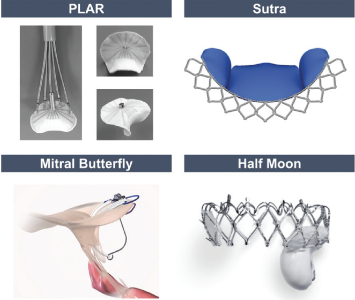 Emerging Technologies for Mitral Valve Repair - Cardiac Interventions Today