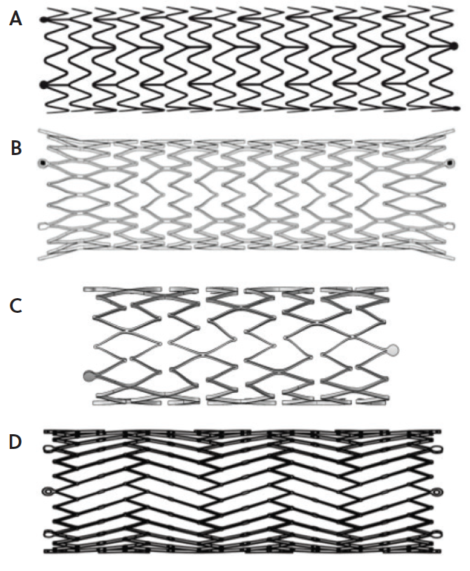 Venous Stenting: A Behind-the-Scenes Look at the Trial Data ...