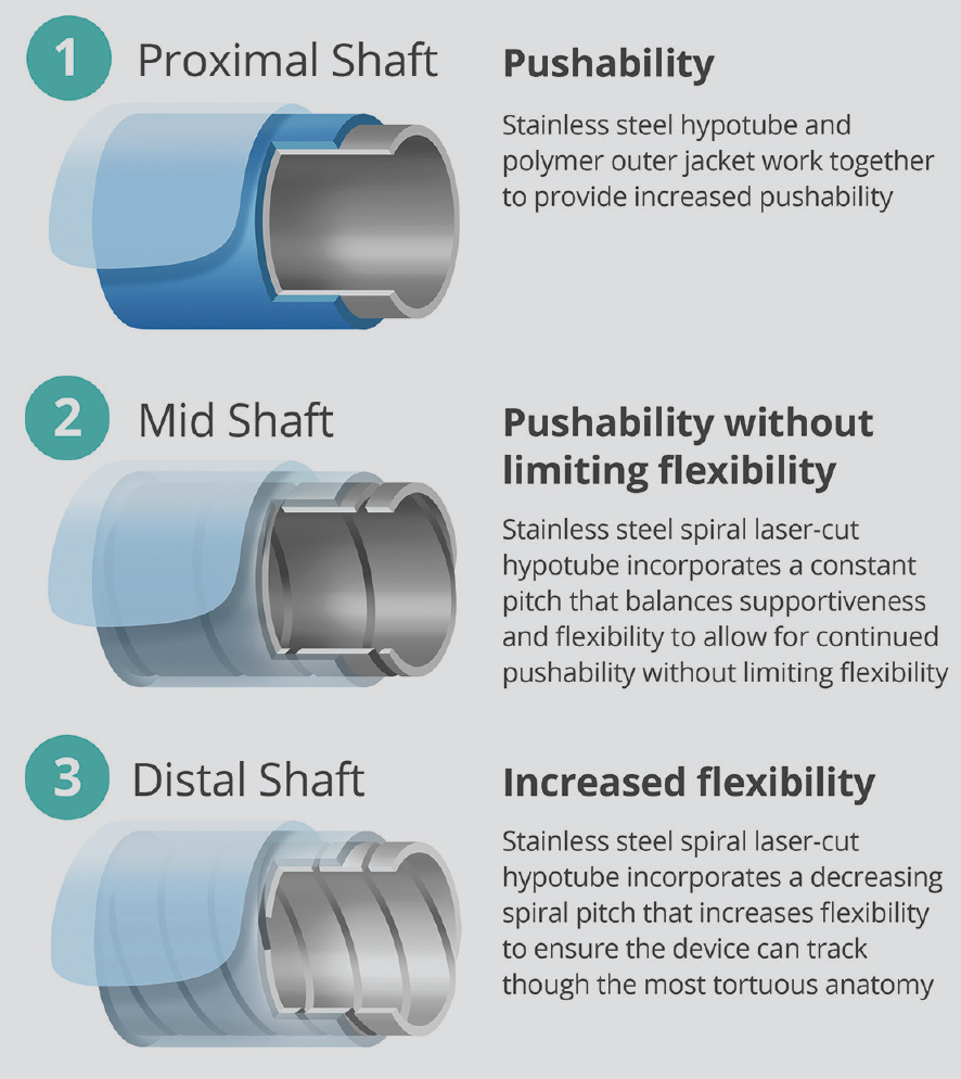 Tackling the Radial Access Equipment Barrier - Endovascular Today
