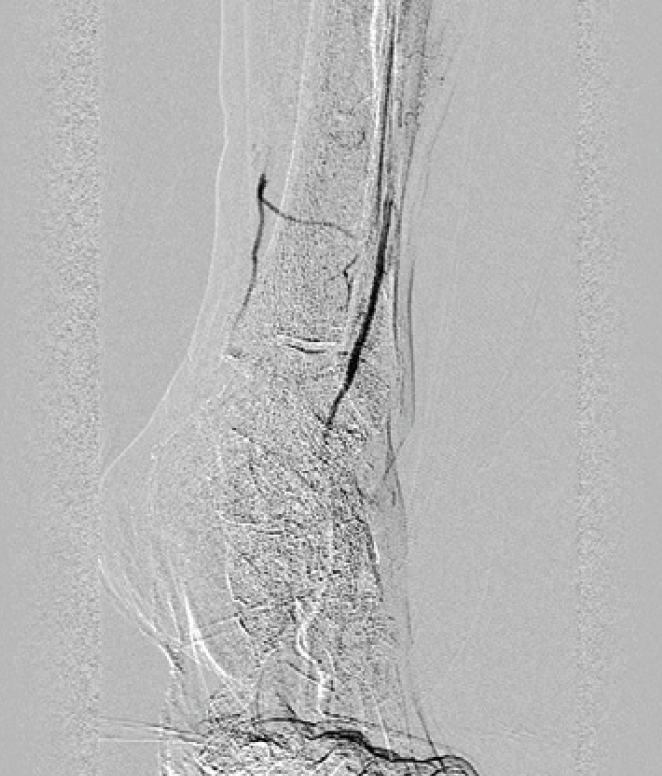 Practice Profile: Longer Equipment Means 50% Growth in Radial-to ...
