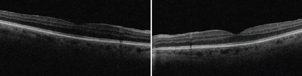 Trouble Brewing - Modern Optometry