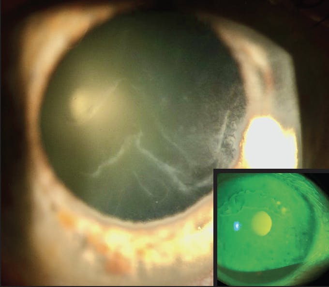 EBMD: Part 1 - Modern Optometry