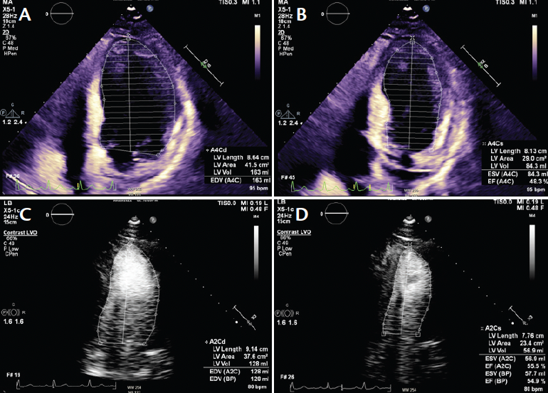 SuperSaturated Oxygen Therapy: Cases and Cocktails Event Winning ...