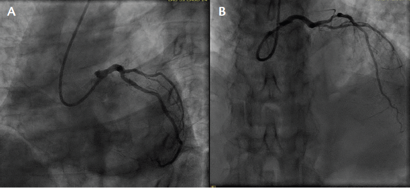 SuperSaturated Oxygen Therapy: Cases and Cocktails Event Winning ...