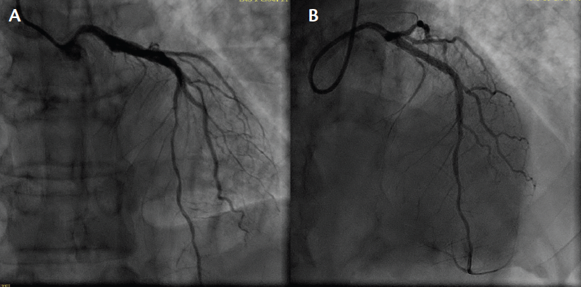 SuperSaturated Oxygen Therapy: Cases and Cocktails Event Winning ...