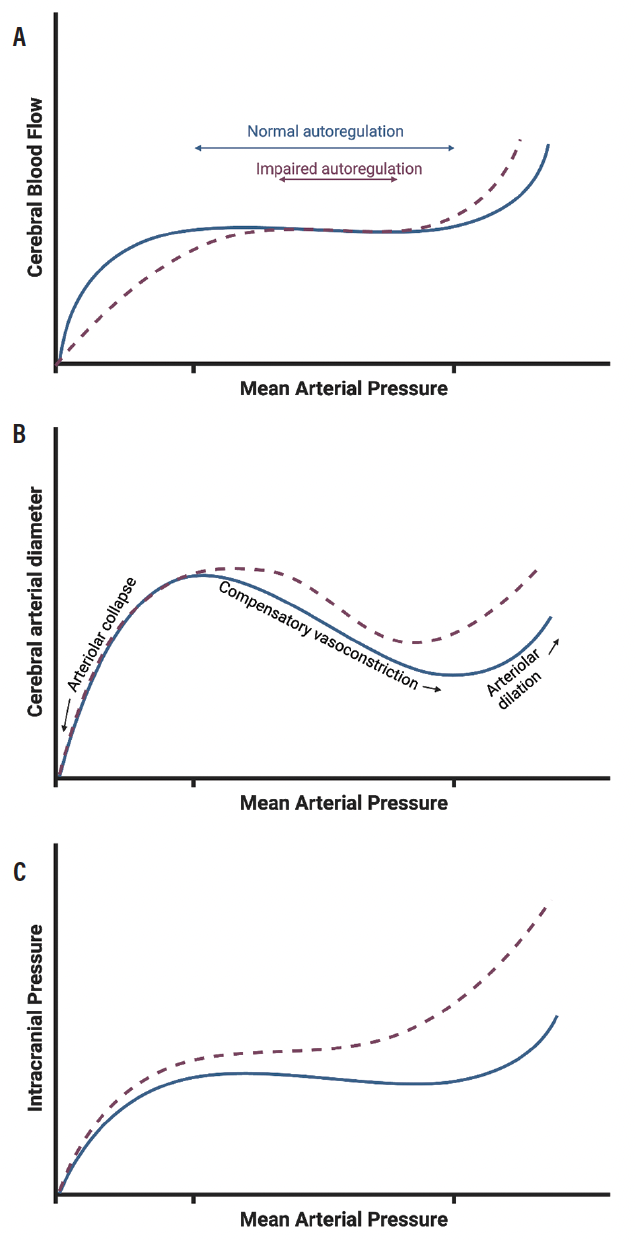 Abnormal Posturing Brain Injury