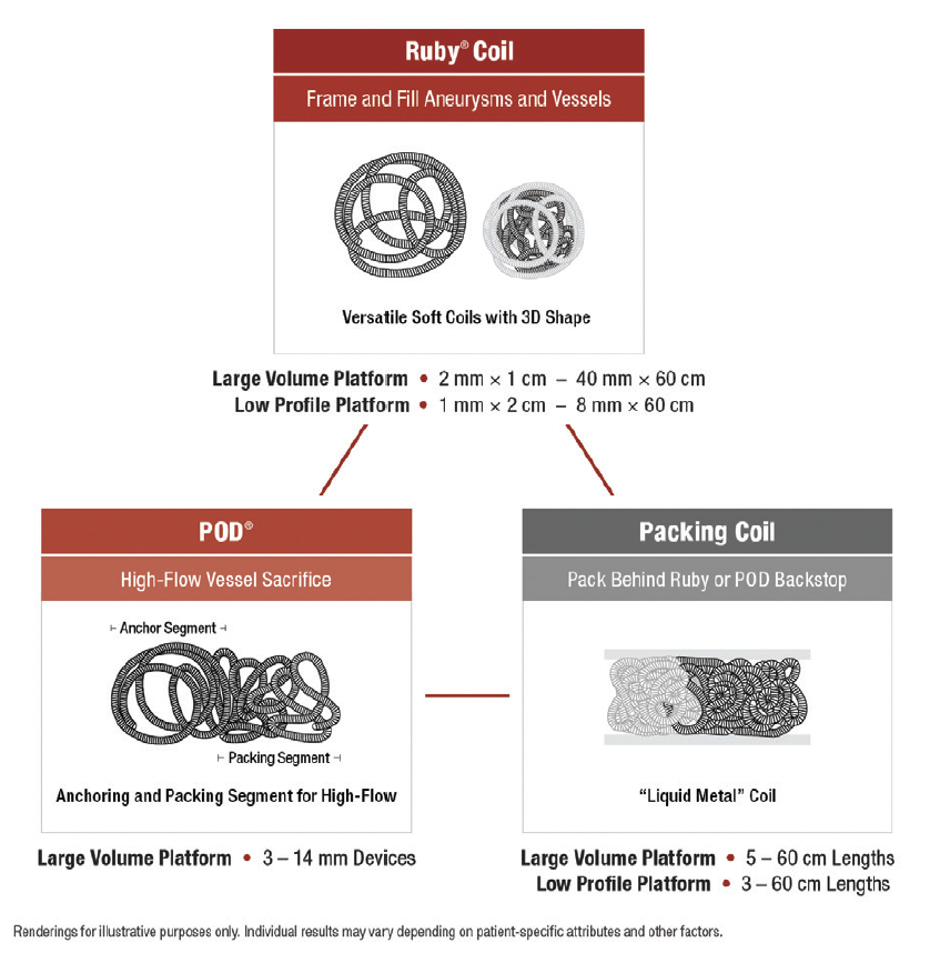 Frame, Anchor, Pack: Simplifying Complex Cases With Penumbra’s ...