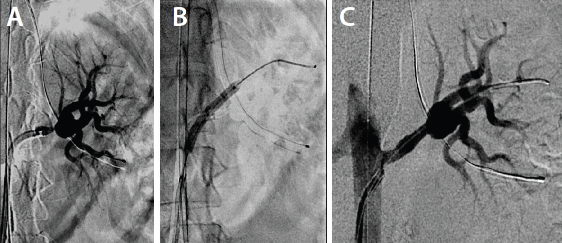 Frame, Anchor, Pack: Simplifying Complex Cases With Penumbra’s ...