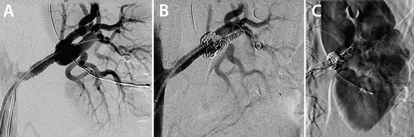 Frame, Anchor, Pack: Simplifying Complex Cases With Penumbra’s ...
