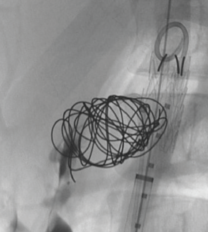 Frame, Anchor, Pack: Simplifying Complex Cases With Penumbra’s ...