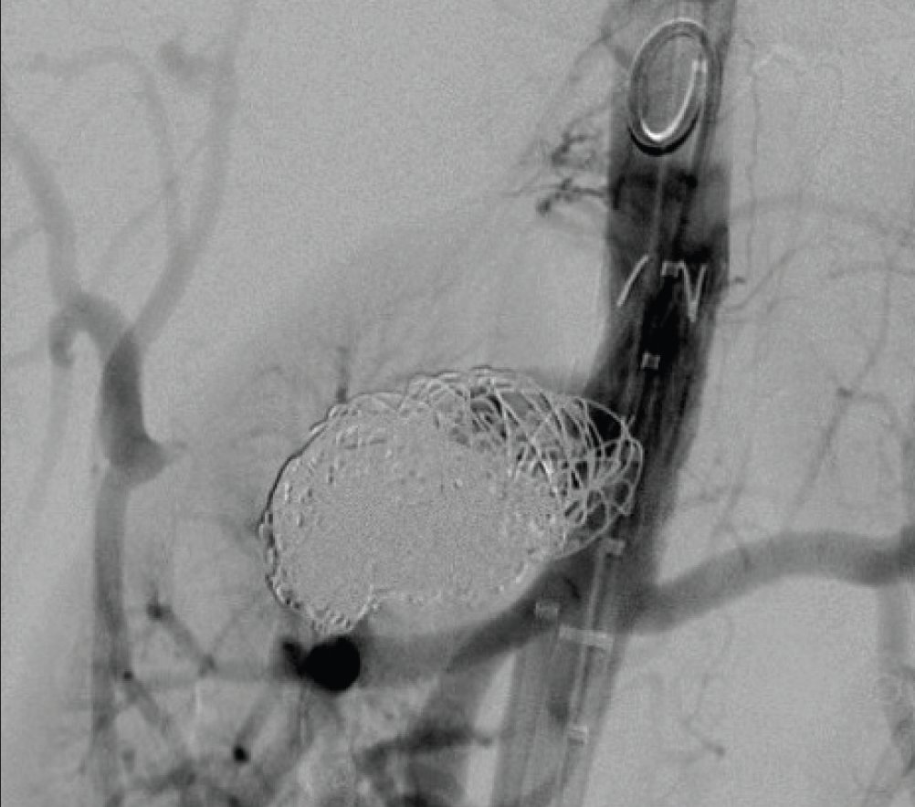Frame, Anchor, Pack: Simplifying Complex Cases With Penumbra’s ...