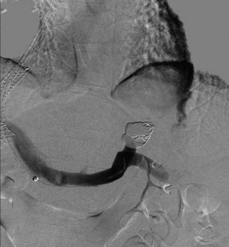 Frame, Anchor, Pack: Simplifying Complex Cases With Penumbra’s ...