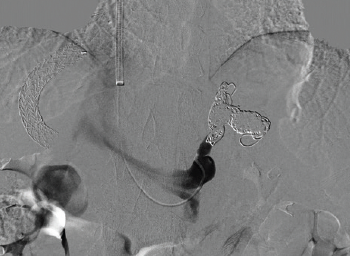 Frame, Anchor, Pack: Simplifying Complex Cases With Penumbra’s ...