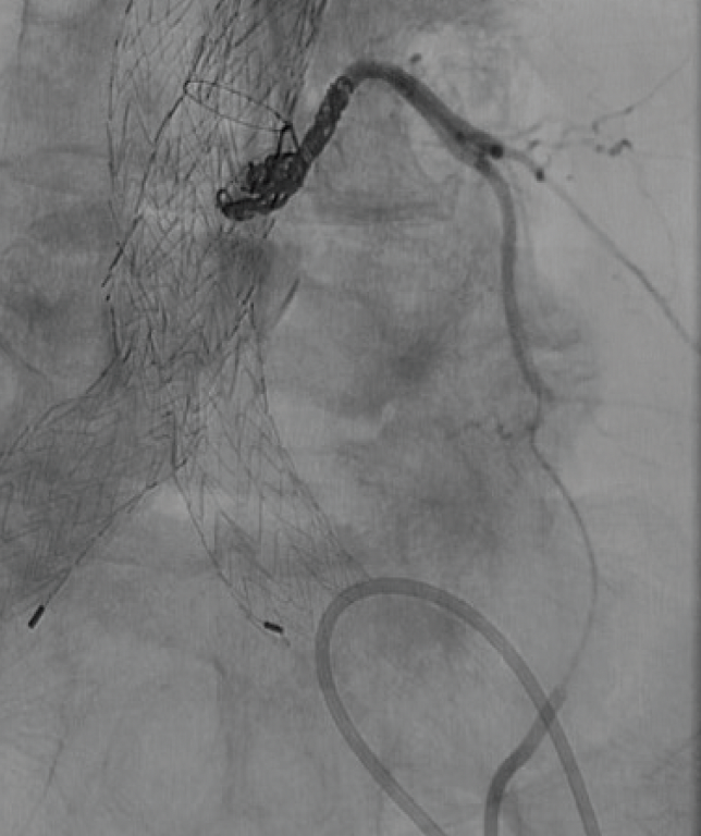 Frame, Anchor, Pack: Simplifying Complex Cases With Penumbra’s ...