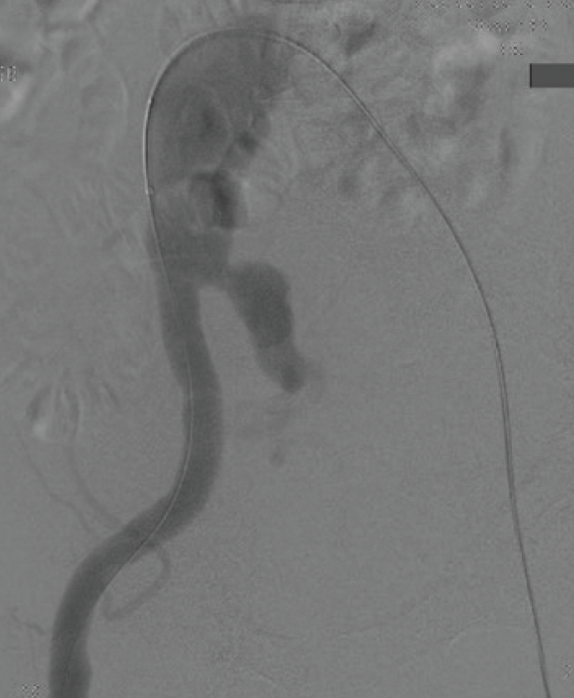 Frame, Anchor, Pack: Simplifying Complex Cases With Penumbra’s ...