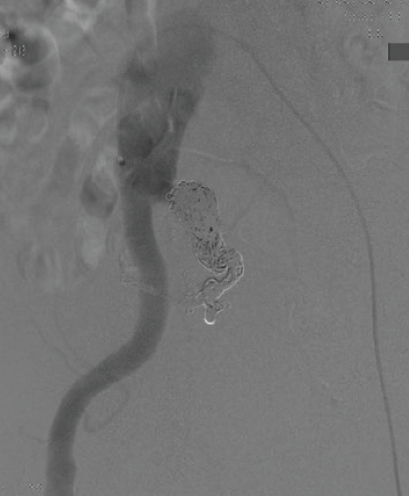 Frame, Anchor, Pack: Simplifying Complex Cases With Penumbra’s ...