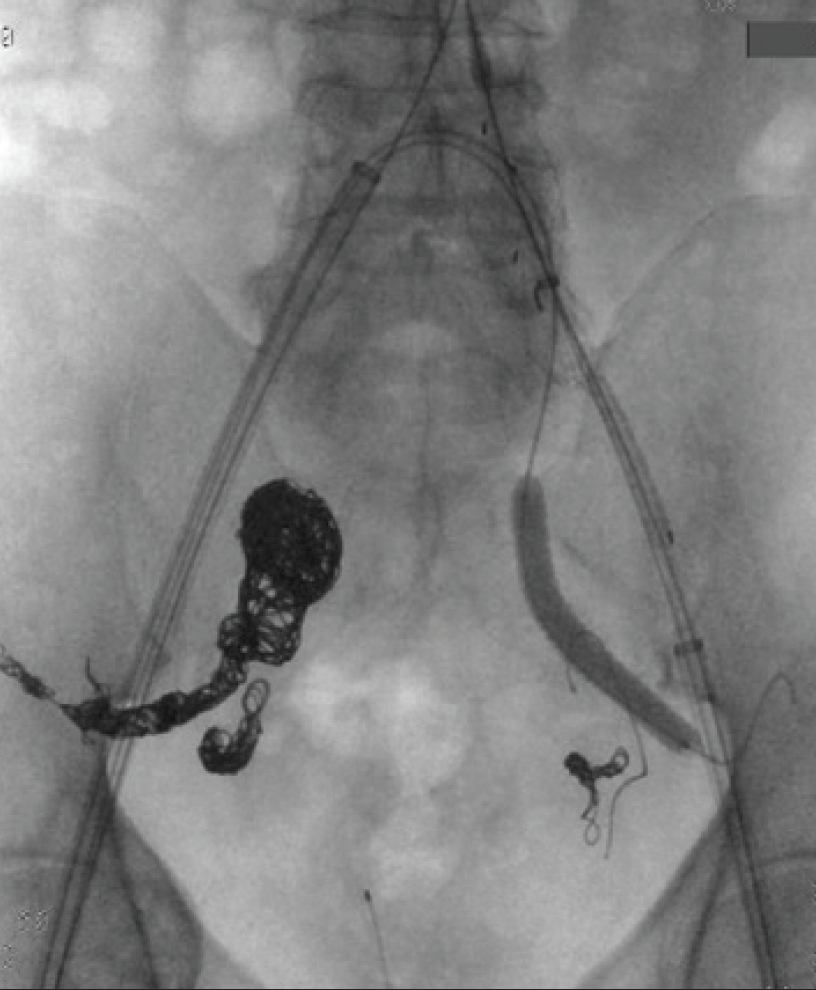 Frame, Anchor, Pack: Simplifying Complex Cases With Penumbra’s ...