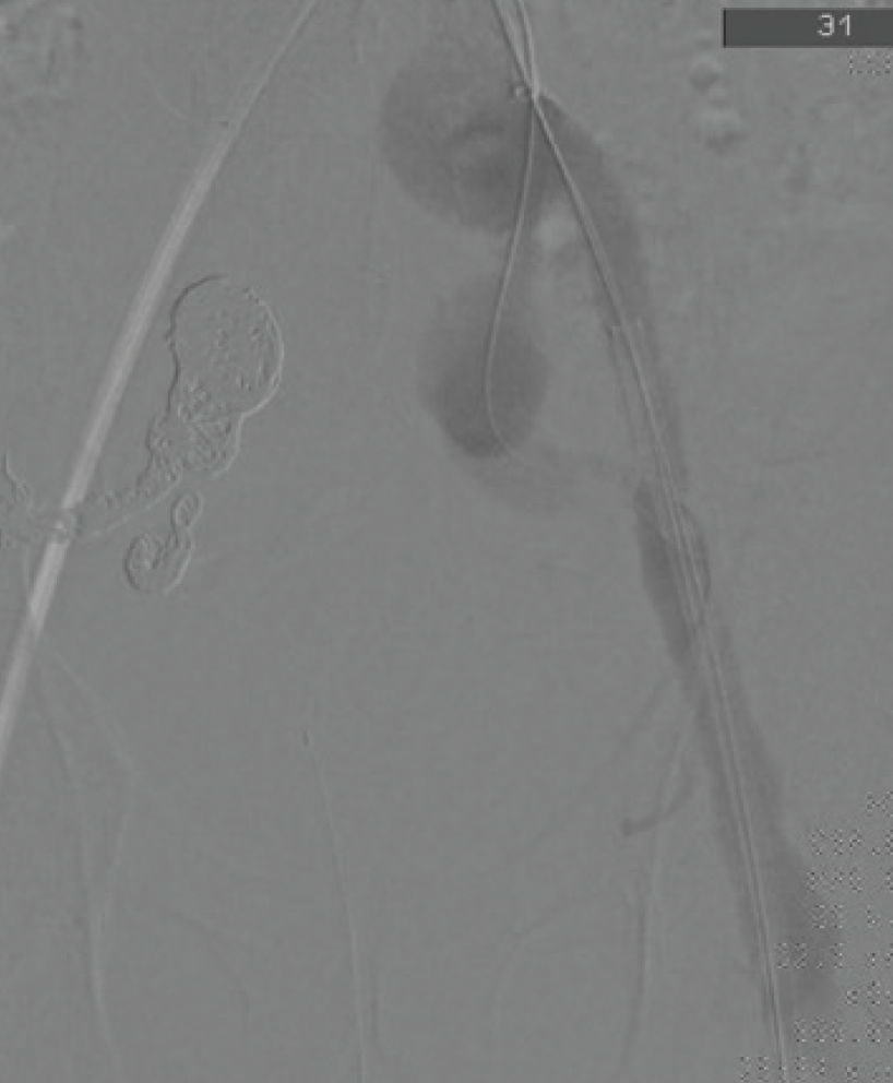 Frame, Anchor, Pack: Simplifying Complex Cases With Penumbra’s ...