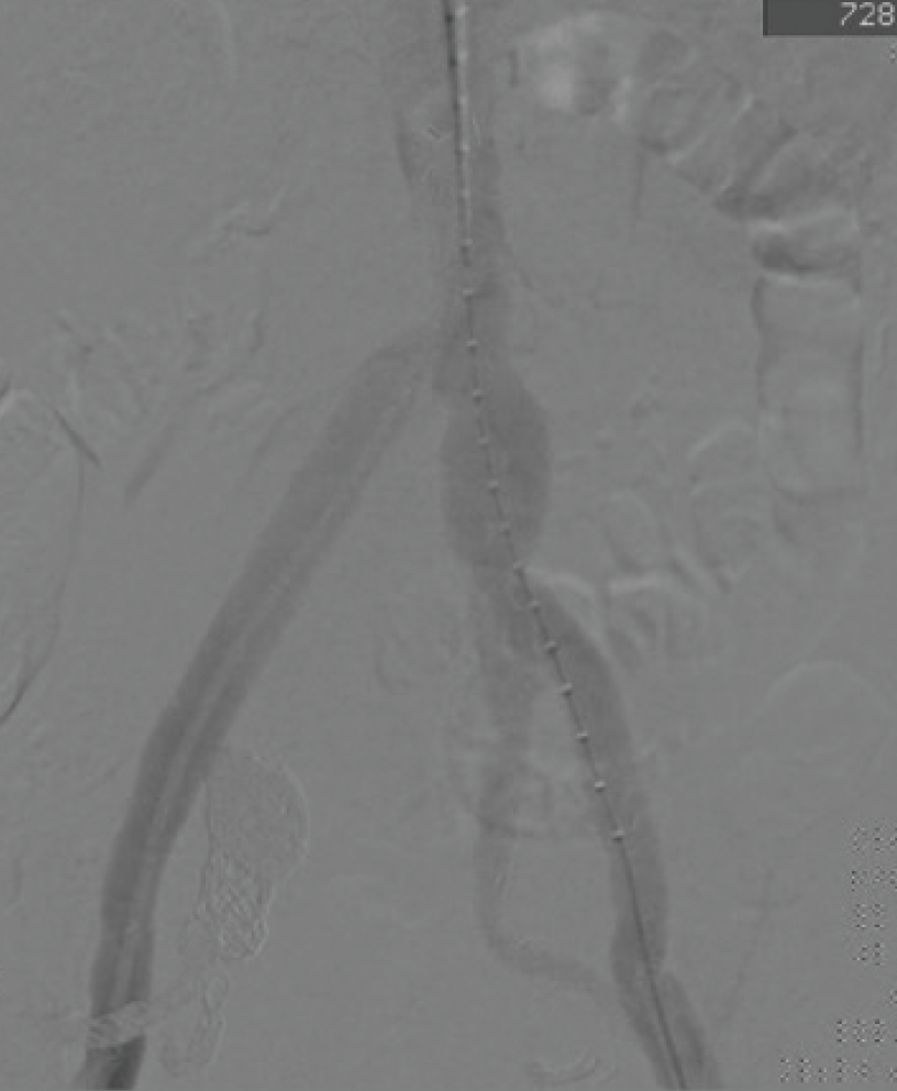 Frame, Anchor, Pack: Simplifying Complex Cases With Penumbra’s ...