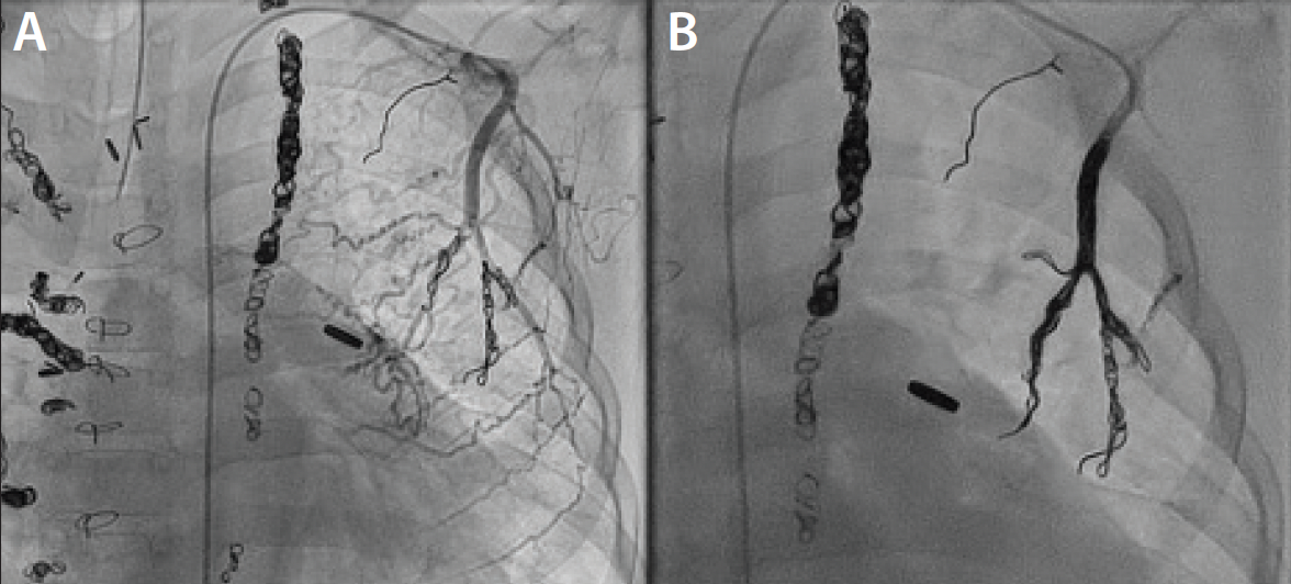 Frame, Anchor, Pack: Simplifying Complex Cases With Penumbra’s ...