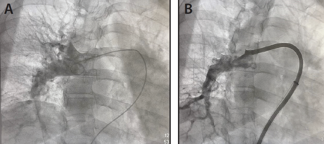 Lightning Flash™: The Most Powerful and Advanced Mechanical ...