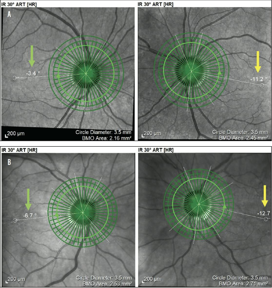 OCT Magic Trick - Modern Optometry