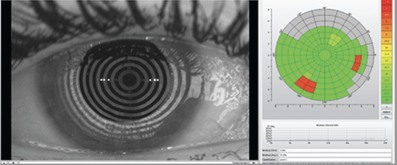Entry Points Into Ocular Aesthetics - Modern Optometry