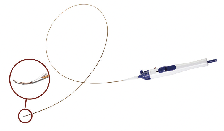 BeBack: An Approach for Heavily Calcified Lesions - Endovascular Today