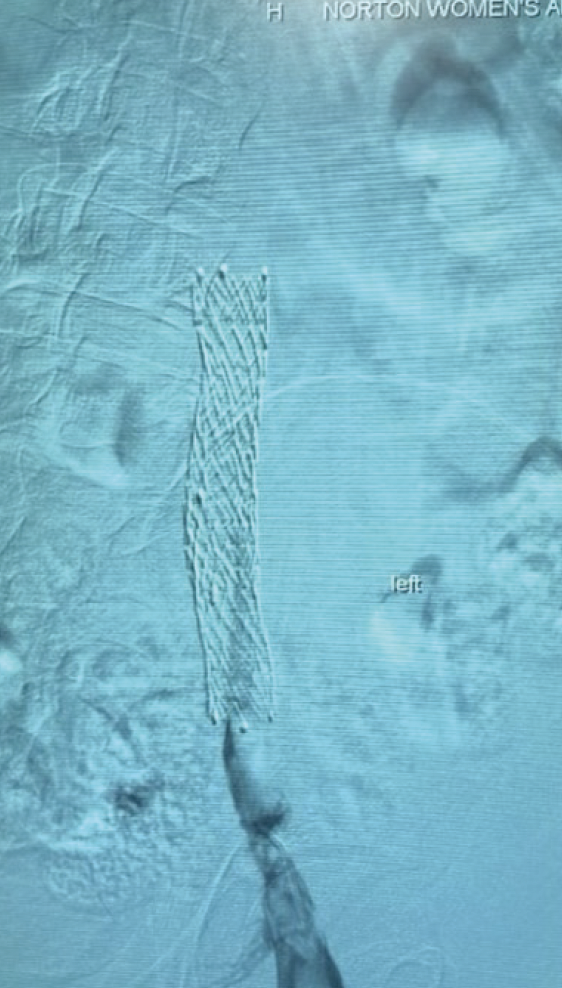 Lightning Bolt™ 7 and Lightning Flash™: The Next Generation of CAT ...