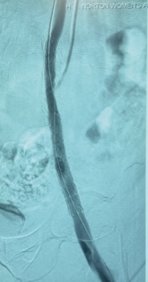 Lightning Bolt™ 7 and Lightning Flash™: The Next Generation of CAT ...