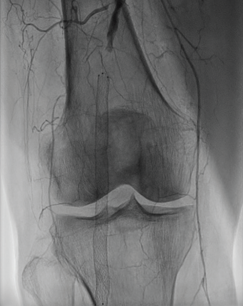 Lightning Bolt™ 7 and Lightning Flash™: The Next Generation of CAT ...