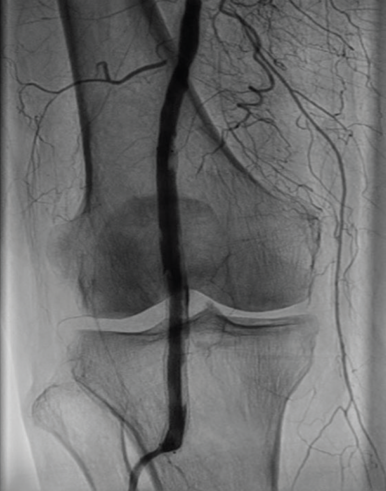 Lightning Bolt™ 7 and Lightning Flash™: The Next Generation of CAT ...