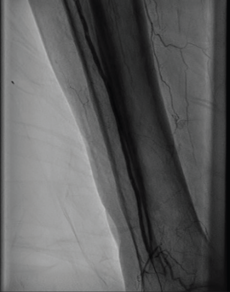 Lightning Bolt™ 7 and Lightning Flash™: The Next Generation of CAT ...