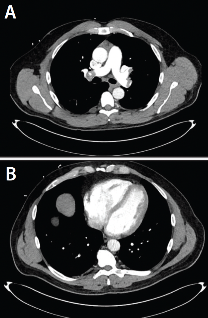 Lightning Bolt™ 7 and Lightning Flash™: The Next Generation of CAT ...