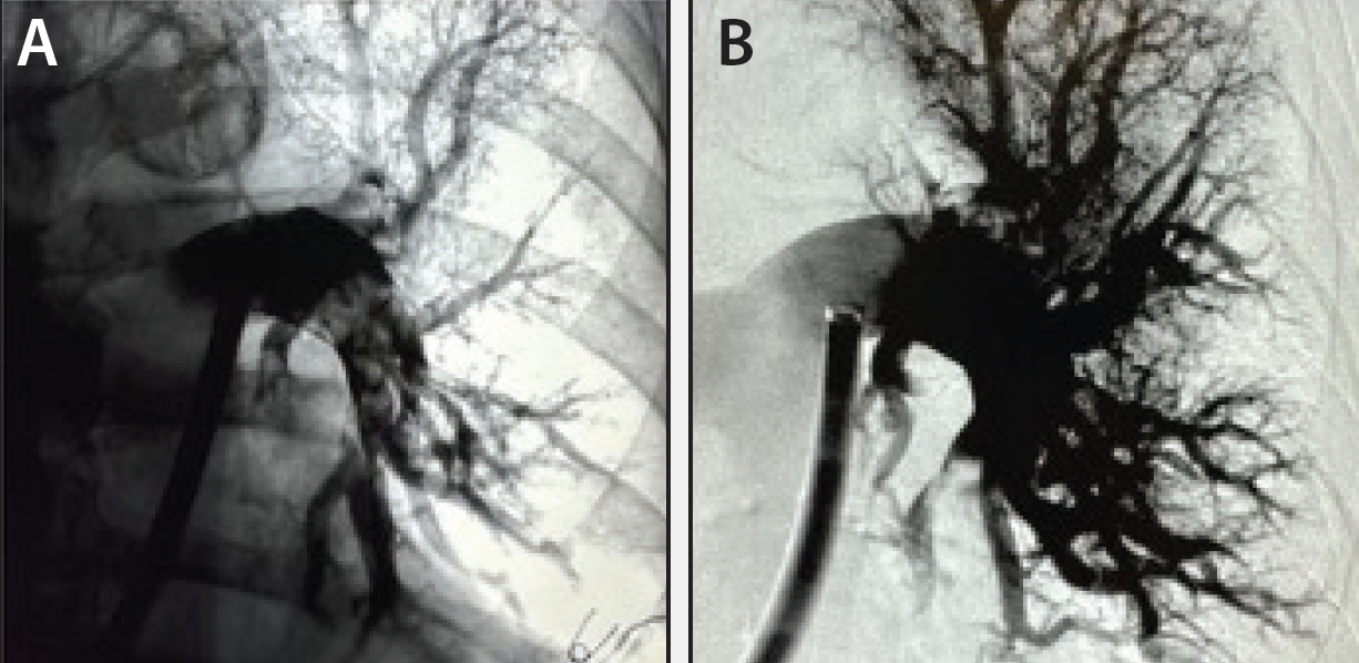 Lightning Bolt™ 7 and Lightning Flash™: The Next Generation of CAT ...