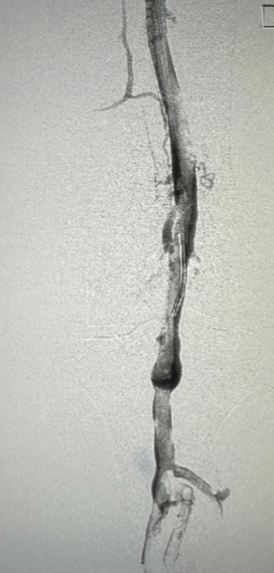 Lightning Bolt™ 7 and Lightning Flash™: The Next Generation of CAT ...