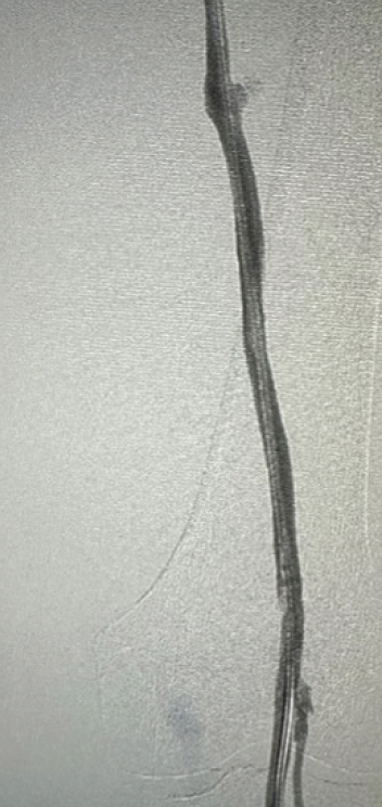 Lightning Bolt™ 7 and Lightning Flash™: The Next Generation of CAT ...